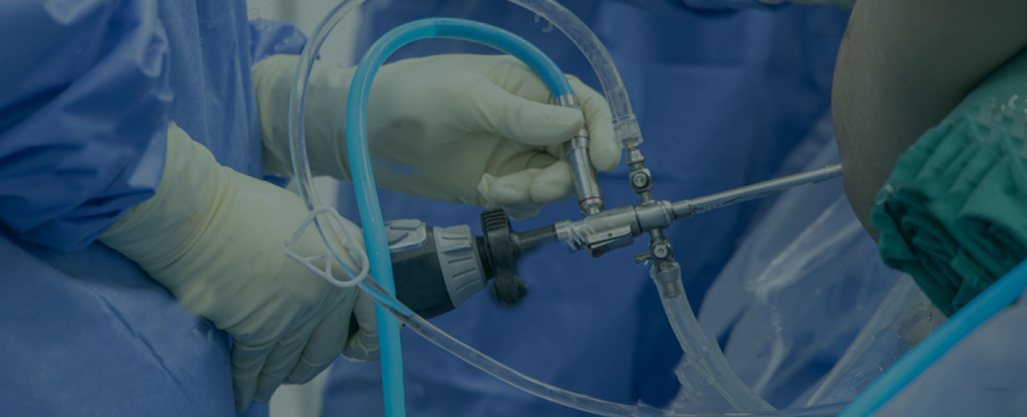 Você sabe o que é OPME? Dica: nenhum centro cirúrgico vive sem eles ...